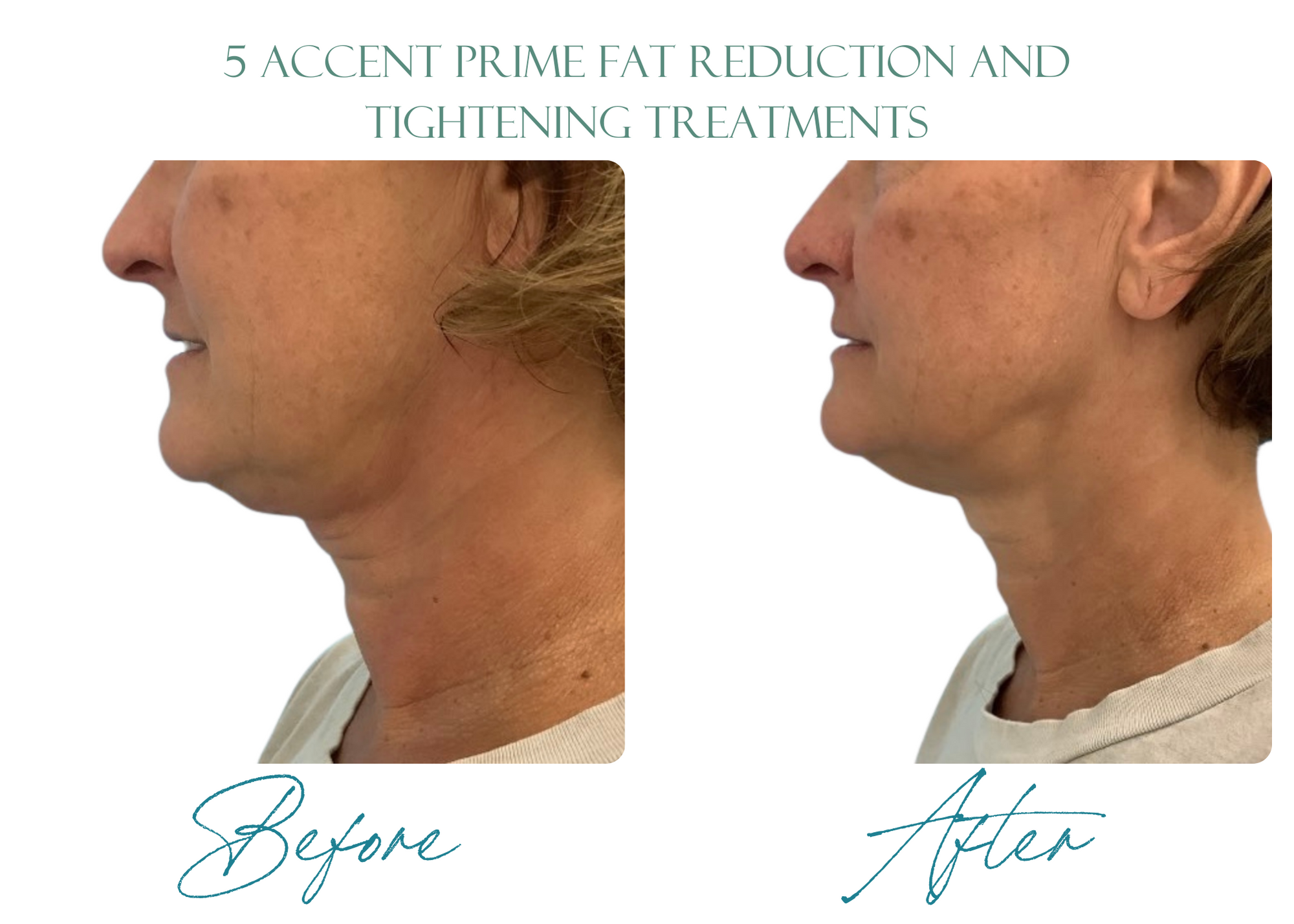 Laser Services in Oxford, MS – DAO