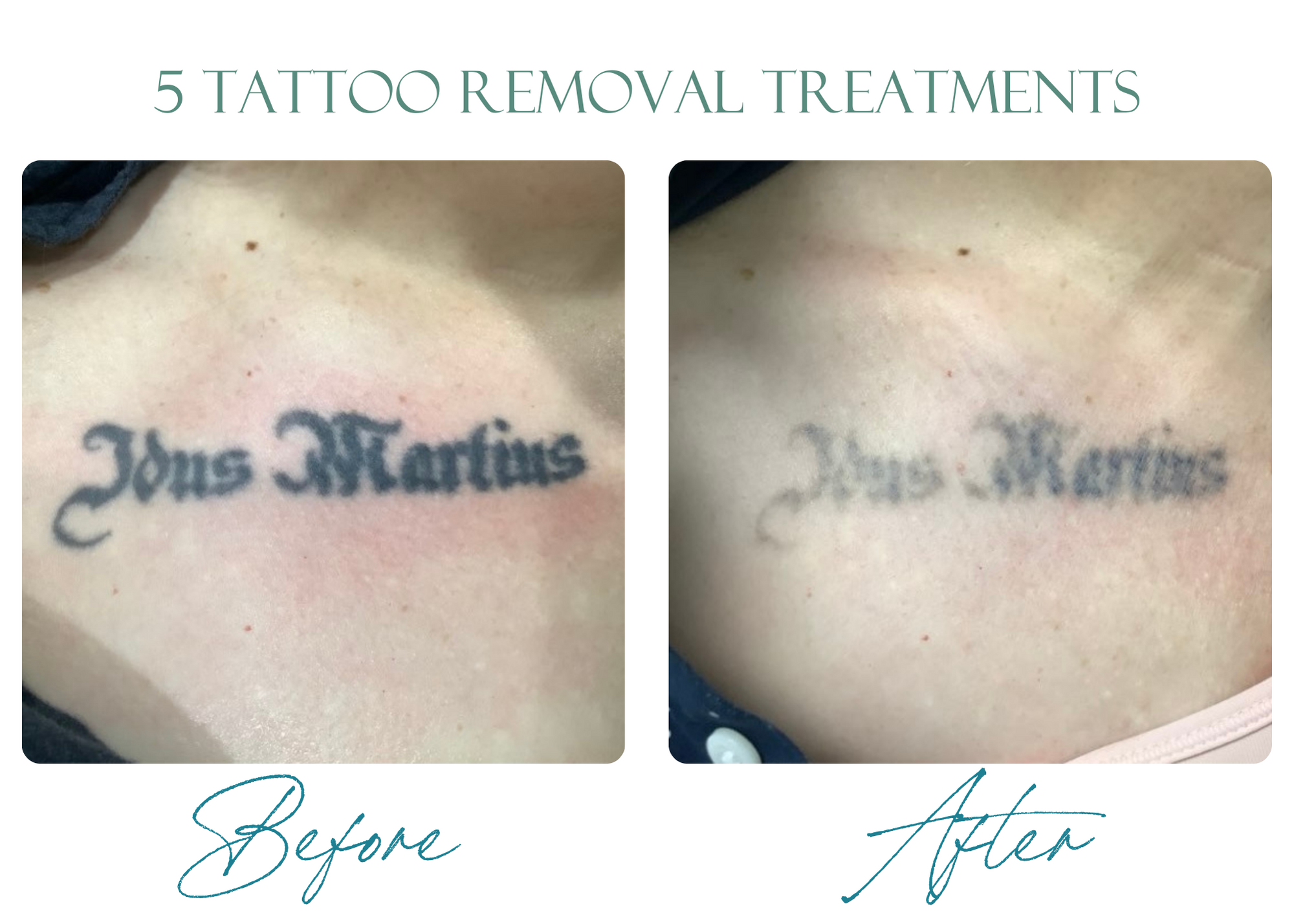 Laser Services in Oxford, MS – DAO